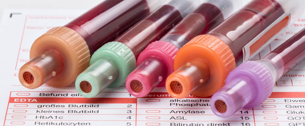 ᐅ Blutwerte & Laborwerte einfach klar und verständlich erklärt