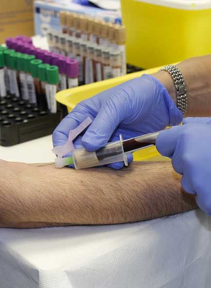 ᐅ Blutwerte & Laborwerte einfach klar und verständlich erklärt